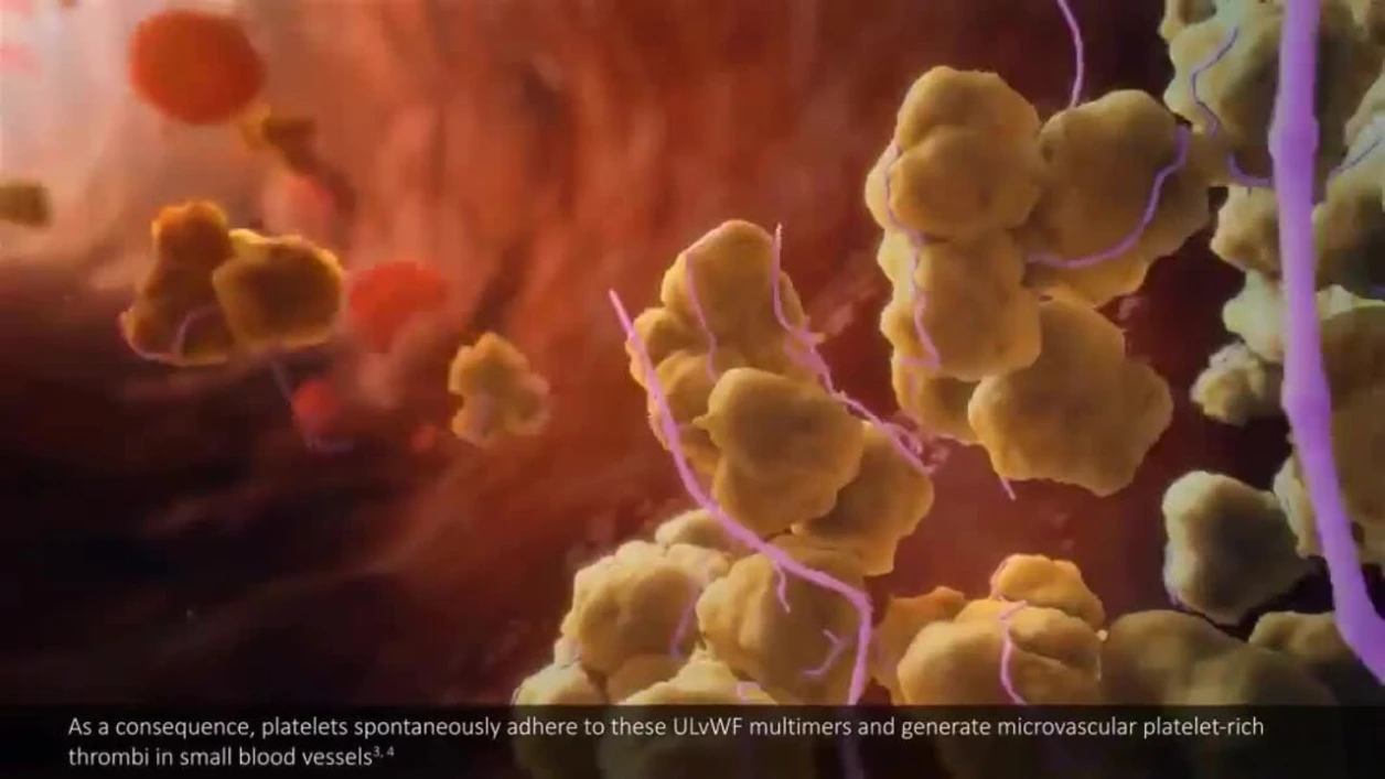 Acquired Thrombotic Thrombocytopenic Purpura (aTTP)