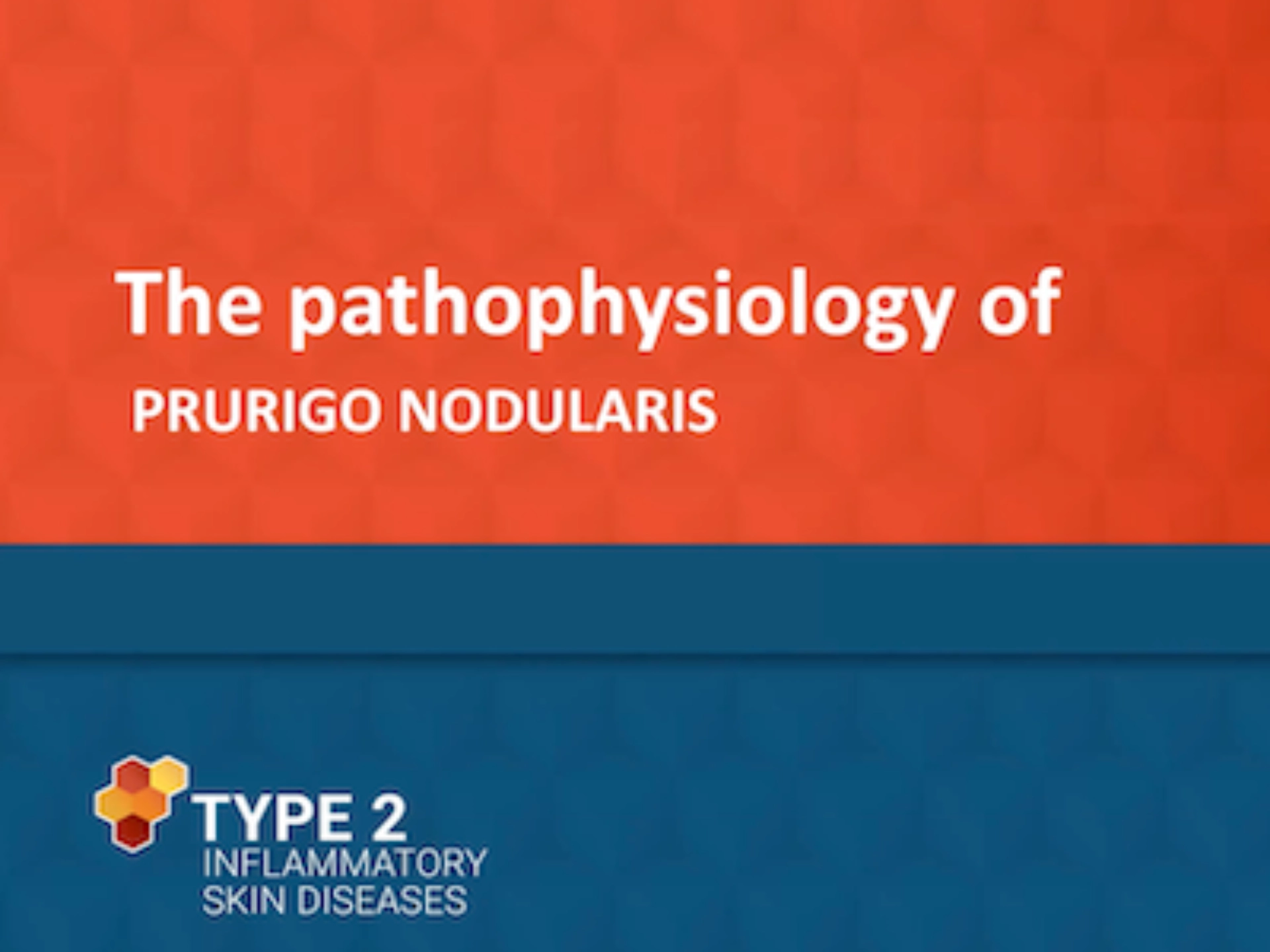Prurigo Nodularis