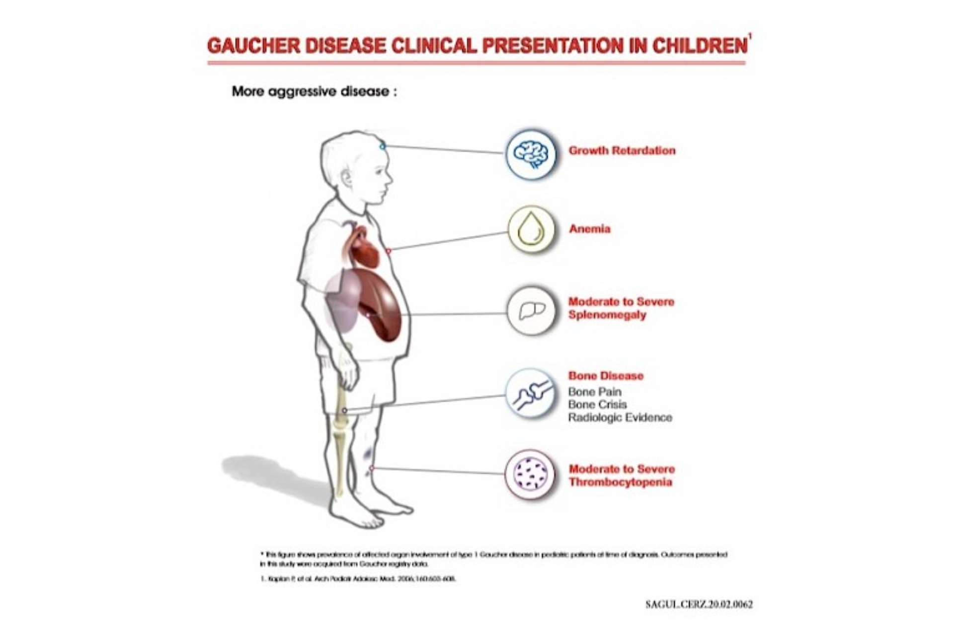 How To Diagnose Gaucher Disease