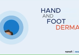 Dermatite des Mains et des Pieds : Introduction Clinique | Campus ...